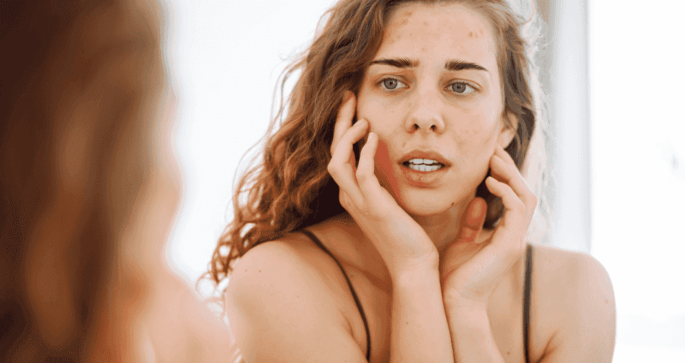 Atrésie des Choanes | Deuxième Avis