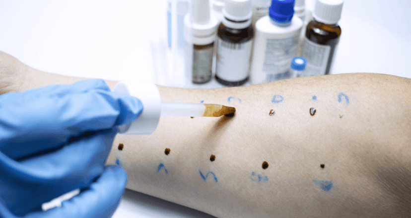 Lymphangiome kystique | Deuxième Avis