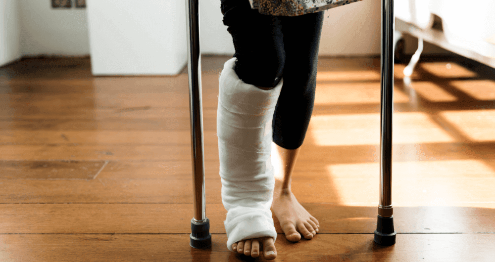 Orthopédie : soigner une jambe cassée