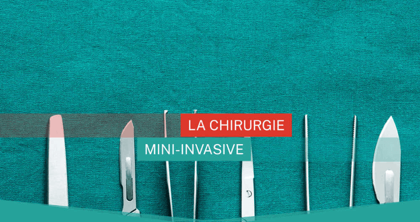 Chirurgie mini-invasive : qu’est-ce que c’est
