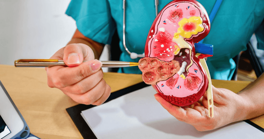 Varicocèle : définition, symptômes et avis de spécialistes